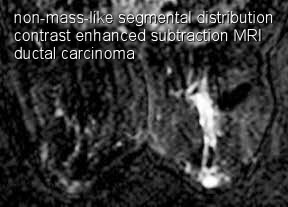 ACR MRI lexicon of the breast
