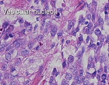 Vesicular nucleli, nucleus and nucleoli - Moose and Doc